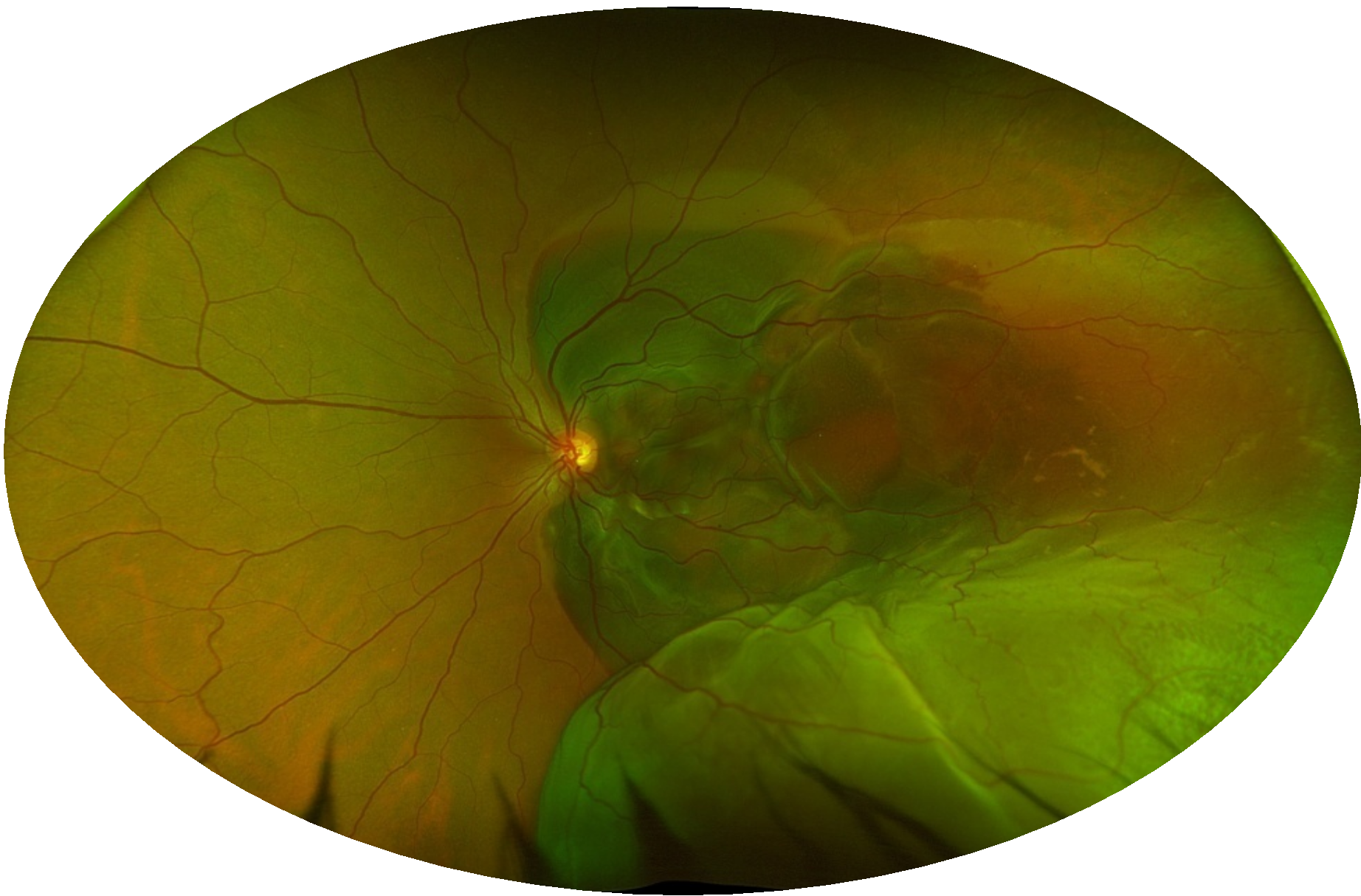 VRSI IMAGE AND VIDEO COMPETITION